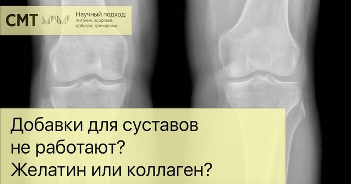 БАДы для суставов- доходчиво | Пикабу