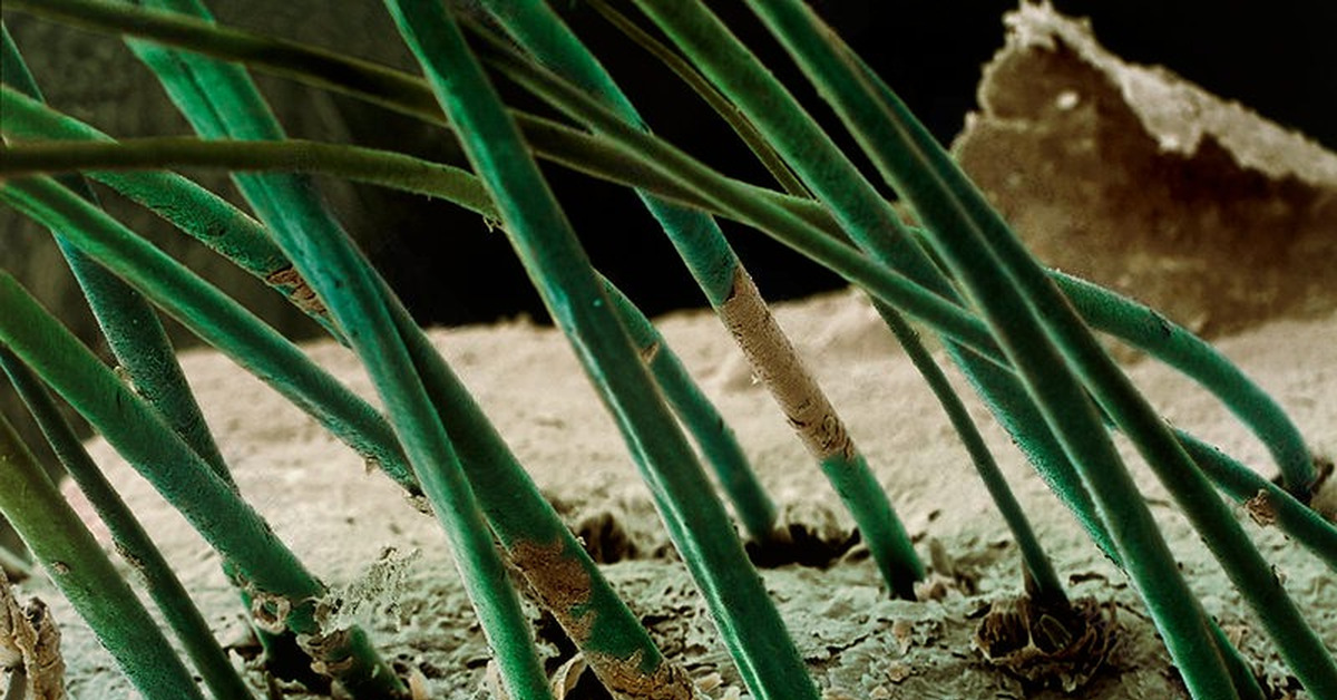 Ресничные клещи под микроскопом | Пикабу